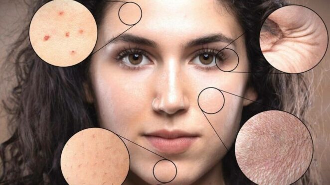 What Are The 10 Most Common Skin Disorders? - Feri.org